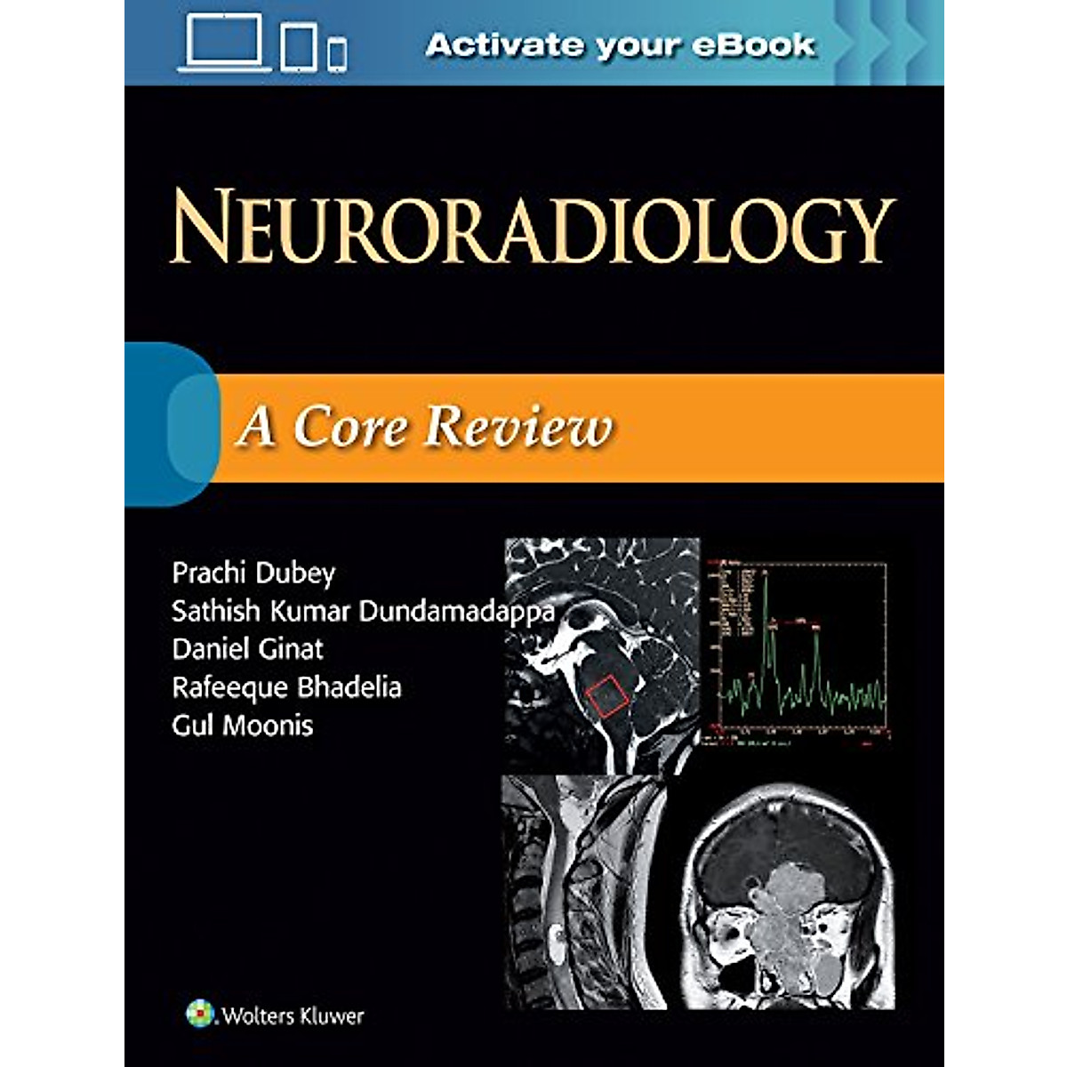 Neuroradiology: A Core Review