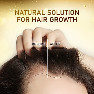 Biotin Hair Growth Serum with Castor Oil, Argan Oil - Hair Loss Prevention Treatment with Hair Regrowth Formula for Women by Beaueli
