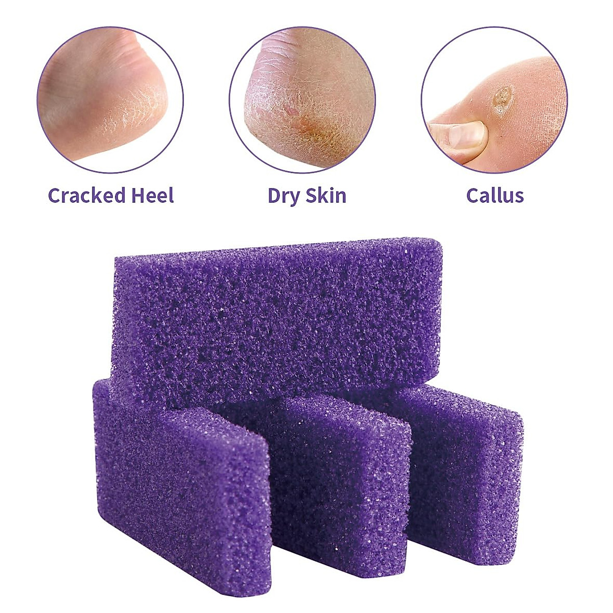 CHAOMAO Disposable Foot Scrubber Pumice Pads, Pedicure Pumice Stone Dead Skin Callus Remover for Feet
