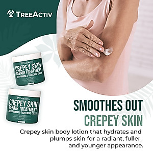 TreeActiv Crepey Skin Repair Treatment, 8oz, Firming Cream For Face and Neck, Skin Firming and Tightening Lotion with Hyaluronic Acid, Crepey Skin Treatment that Moisturizes Dry Crepe Skin, 500+ Uses