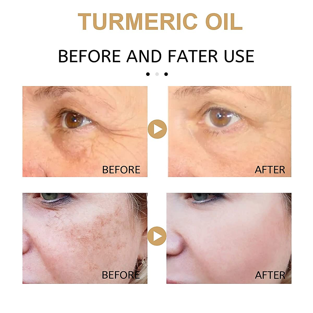 2Pack Turmeric Corrector Serum, Natural Turmeric Repair Face Serum for Face, Hydrate and Dry Skin