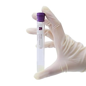 24 Tubes 12ML PRP Tubes for Platelet Rich Plasma Pyrogen Free and High Quality