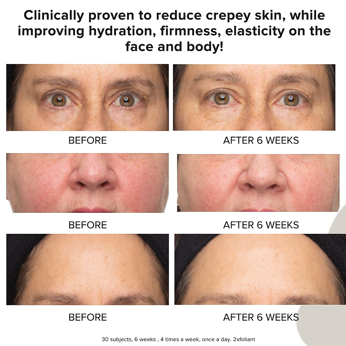 Priori Skincare 2xfoliant Peel + Scrub for Face and Body Lactic Acid Retinol Vitamin C, E At-Home Microdermabrasion Anti-Irritant Dermatologist Tested 6.8 fl oz