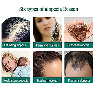 Hair Growth Serum, Hair Loss Treatments, Hair Serum, Hair Growth Oil for Thicker Longer Fuller Healthier Hair, Help Hair Follicle Growth, Prevent Hair Loss and Thinning, With Natural Vitamin Rich Trea