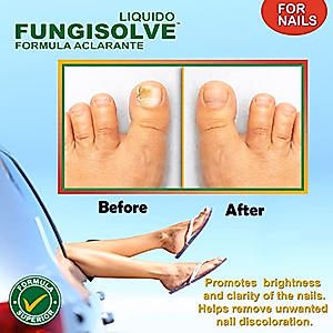 Fungisolve Nail Clarifying - clears out keratin debris where nail fungus thrives 1oz