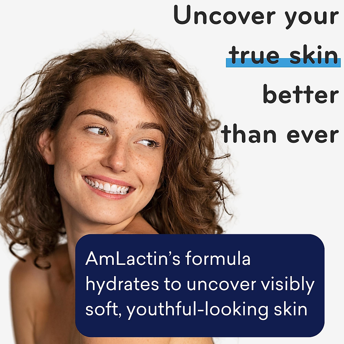 AmLactin Intensive Healing Body Cream, 12 oz Tub, 2-in-1 Exfoliator and Moisturizer for Dry Skin with 15% Lactic Acid and Ceramides for 24-Hour Moisturization