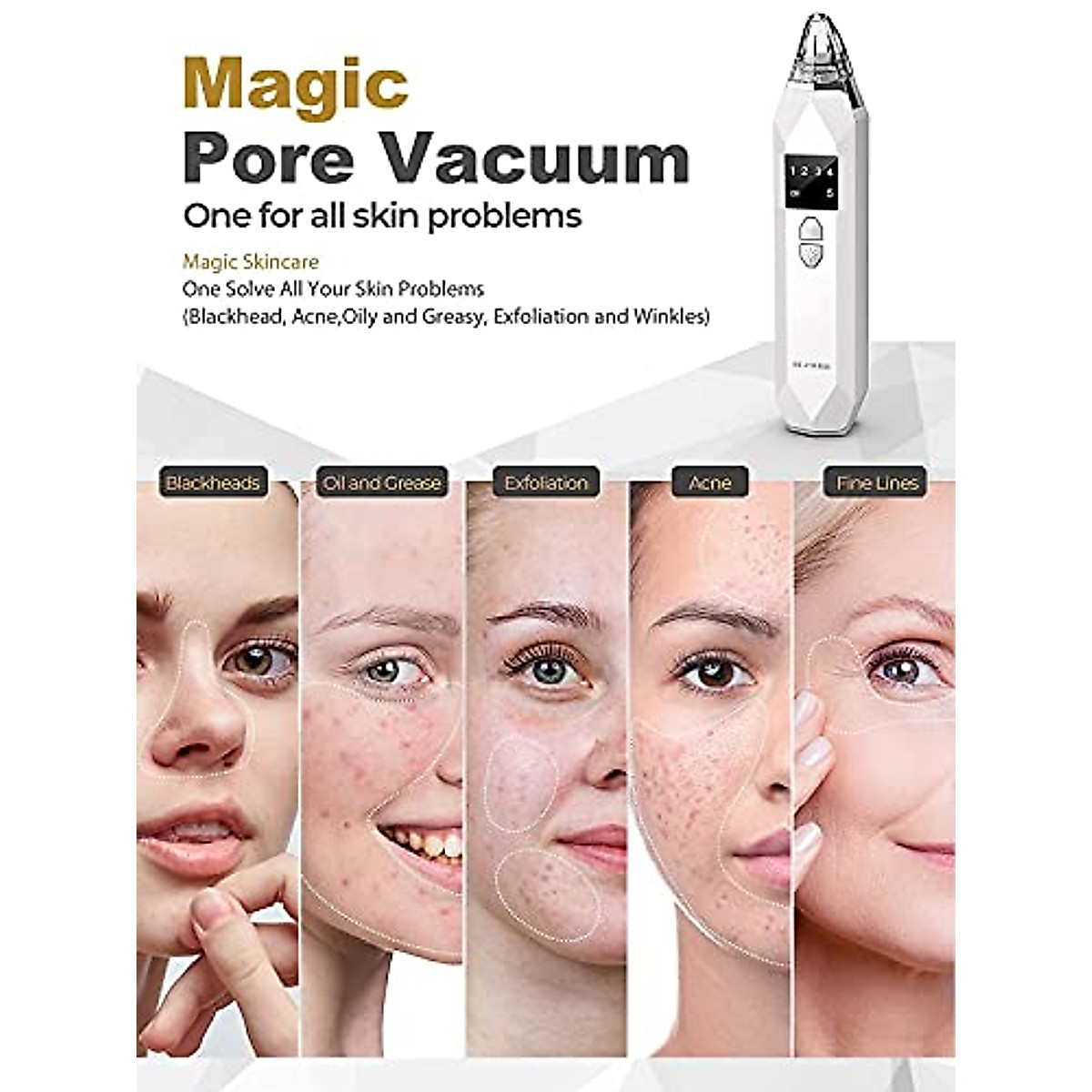 Blackhead Remover Pore Vacuum EUHOME Electric Rechargeable Blackhead Whitehead Acne Comedone Pimple Extractor Facial Pore Cleaner Blackhead Removal Kit 5 Suction Probes Face Cleaning Tools