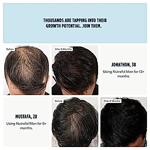 Nutrafol Men's Hair Growth Supplement | Clinically Effective for Visibly Thicker & Stronger Hair with More Scalp Coverage | Dermatologist Recommended | 1 Refill Pouch | 1 Month Supply