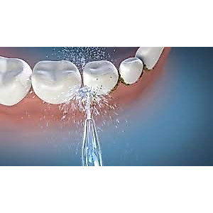 Classic Jet Tips Compatible with Waterpik Water Flosser - Pack of 2