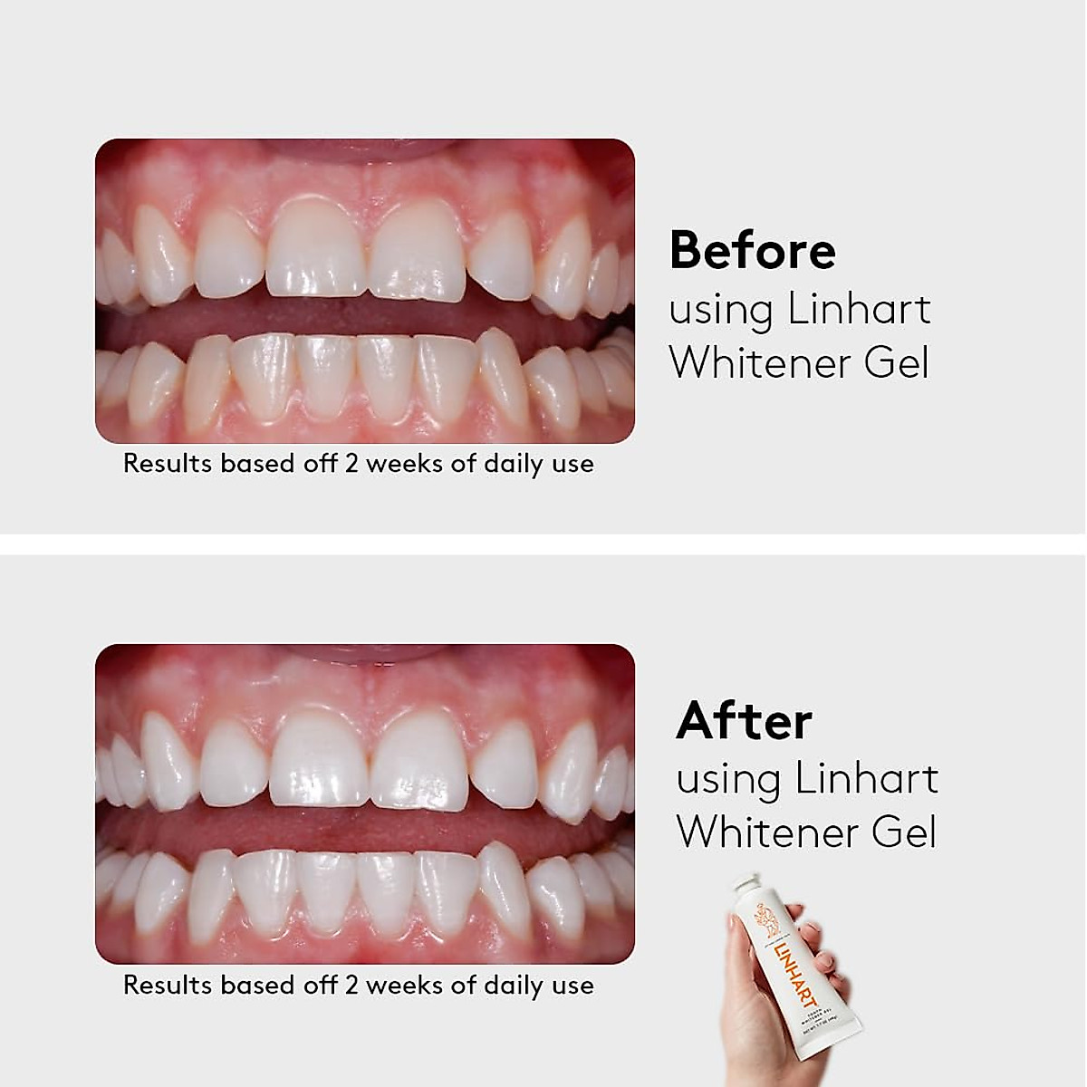 LINHART Teeth Whitening Kit with LED Light - Tooth Whitener Gel, Dental Whitening Gel Syringes with 35% Carbamide Peroxide and 16-Led Whitening Light - No Sensitivity, Whitens Teeth
