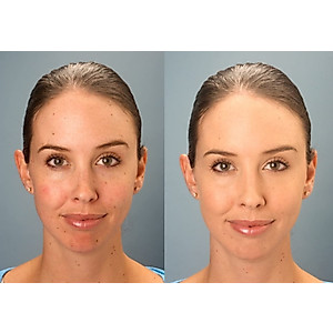 Dr. Denese Advanced SPF 30 Defense Day Cream | BB CREAM | UNIVERSAL SHADE | 2oz |