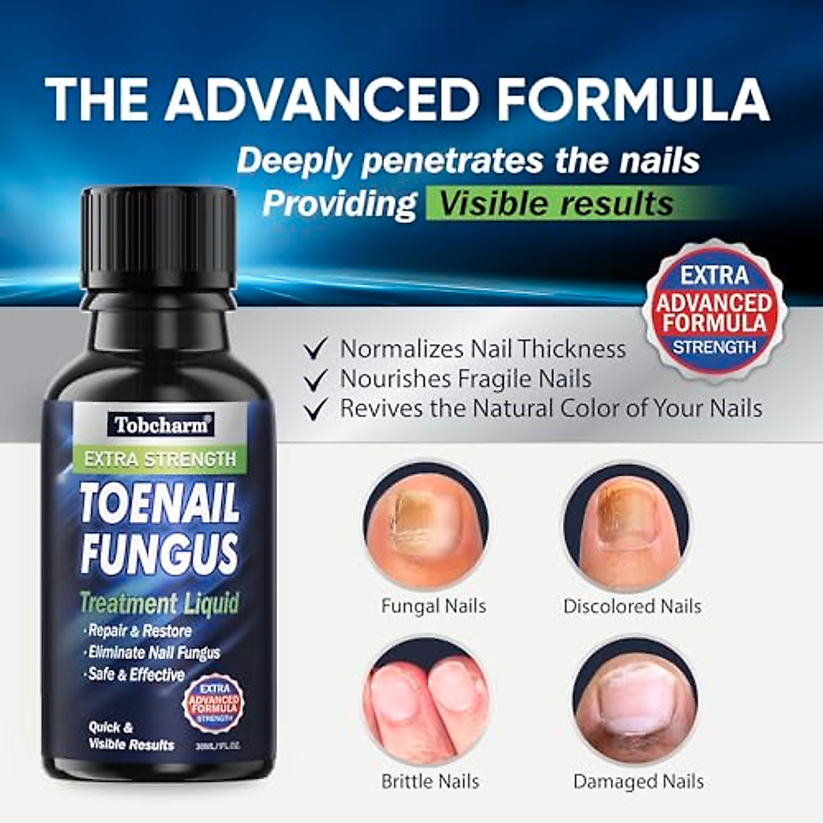Tobcharm Toenail Fungus Treatment Extra Strength, Nail Fungus Treatment for Toenail, Fungus Nail Treatment, Nail Fungus Treatment for Fingernails (1oz)