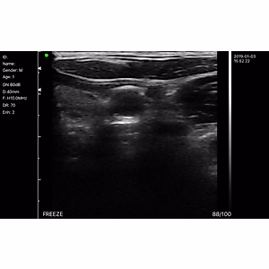 SonoQue Portable Wireless Linear Veterinary Ultrasound Scanner Probe (7.5-10MHz) for iOS and iPad Tablet