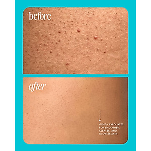 Truly Beauty KP Treatment Moon Rocks Sugar Scrub - Gentle and Fluffy Body Scrubs for Women Exfoliation, Natural Body Scrub - Body Exfoliating Scrub with Vitamin E and Essential Antioxidants.