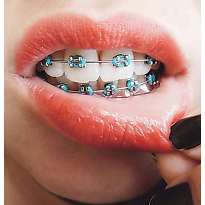 Dental Orthodontic Ligature Ties and Orthodontic Ligature Gun Tools Teeth Orthodontic Ligature Ring Rubber Bands Multi-Color(1040 Pcs/Bag)