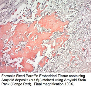 Amyloid Stain Pack (Congo Red), 500ml