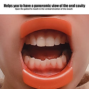 3pcs O Shape Lip Retractor - Dental O Shape Lip Retractor Opener Oral Mouth Cheek Lip Opener O Shape Mouth Opener Mouth Cheek Lip Dental Accessory