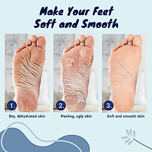 Melzu Foot Peel Mask for Enhanced Foot Care, Repair Heels & Removes Dry Dead Skin for Soft Baby Feet, Exfoliating Foot Peel Mask for Hard Skin. Natural, Easy to Use at Home, Fits for Women & Men (1 pair)