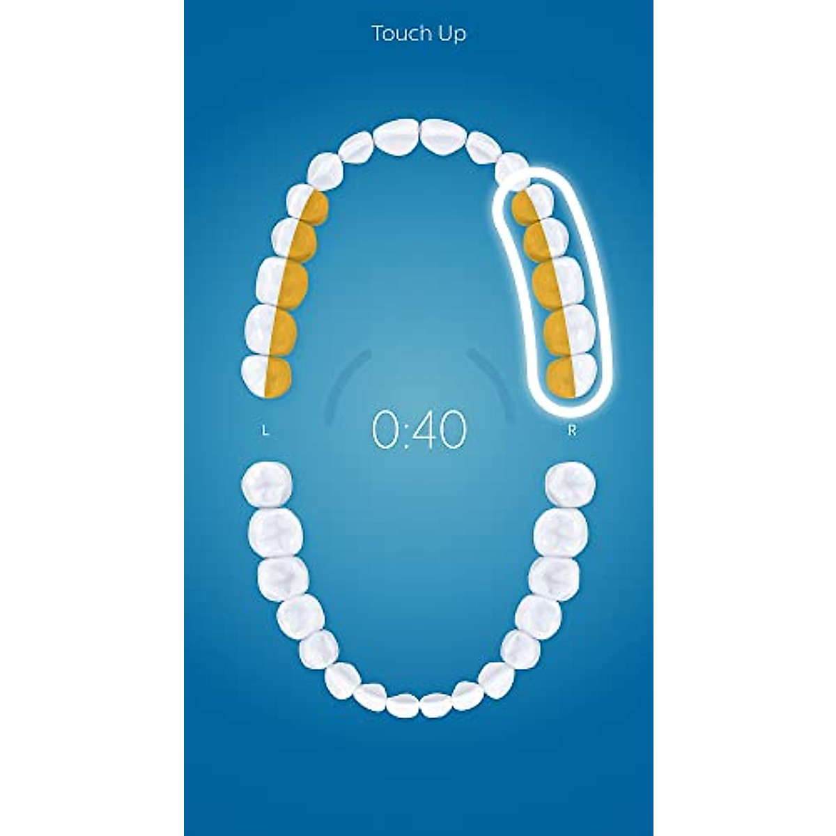 Philips Sonicare DiamondClean Smart 9500 Rechargeable Electric Power Toothbrush, Grey, HX9924/41