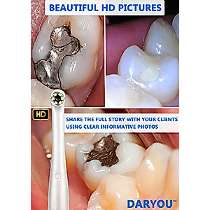 Intraoral Camera Dental Camera DARYOU DY-60 720P HD 4X Zoomable. Button Work w/Eaglesoft,Dexis,Carestream,Suni More