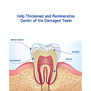 CAREDO Cavity Repair Toothpaste Set for Adults, 16g Pulpitis Ointment for Tooth Decay Pain Repair & 100g Hydroxyapatite Toothpaste for Home Cavity Repair, Cavity Tooth Repair Fluoride Free Toothpaste