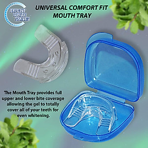 Bright White Smiles Teeth Whitening Kit | LED Light Activated Teeth Whitener | With 2x 5ml 35% Carbamide Peroxide Gel Syringes | Comfort Fit Mouth Tray & Case | For Home Use | Professional Results