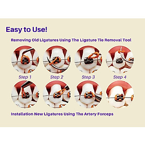 Dental Braces Color Changing Kit, Orthodontic Ties Changing kit, Change The Color of Your Braces Yourself in Minutes Ligas para Brackets Ortodoncia