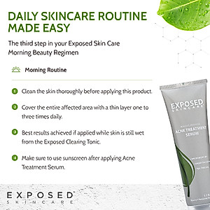 Exposed Skin Care Acne Treatment Serum Step 3 – Quickly Reduces Pimple Size and Redness - 12 Hour Spot Treatment - 3.5% Benzoyl Peroxide, Natural Green Tea & Tea Tree Oil