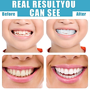 2 Set Fake Teeth Denture Teeth Veneer Snap in Teeth Confidence Smile Dentures Veneer Fake White Teeth with 2 Pieces Mini Tweezers for Halloween Men and Women Bad Teeth Whitening Alternative