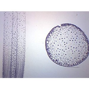 EISCO Ascaris & Onion Mitosis, Prepared Microscope Slide - 75 x 25mm - Plant & Animal Mitosis, Introductory Microscopy