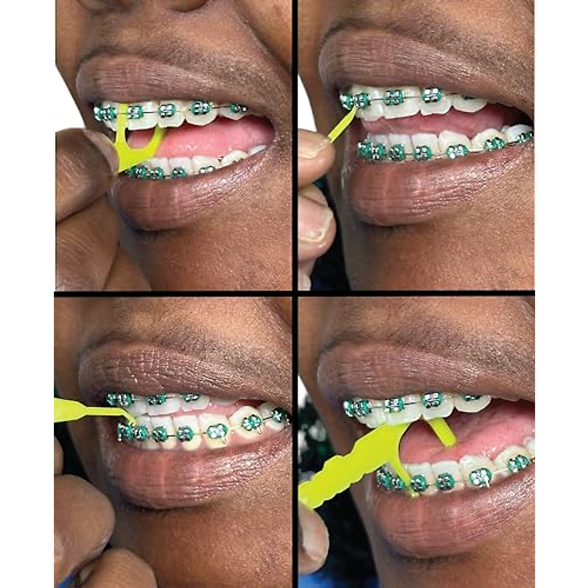 Flosser for Braces| Ortho Floss| 300 Count Bag| Pack of 6 Bonus 4 Interdental Brush| Floss Dental Pick Fits Between Brace Wire and Teeth| Quick and Easy Braces Floss